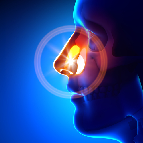 Balloon Sinus Surgery NYC | Non Invasive Sinus Surgery